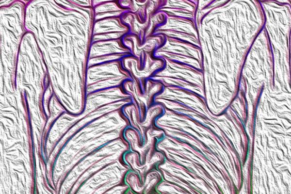 Symptoms - APEX Spine 2023